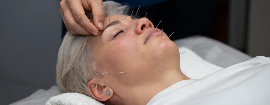 Top 5 Reasons To Try Acupuncture For Better Health - Ellicott ...